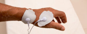 Electrical Stimulation Mount Clemens & Macomb, MI